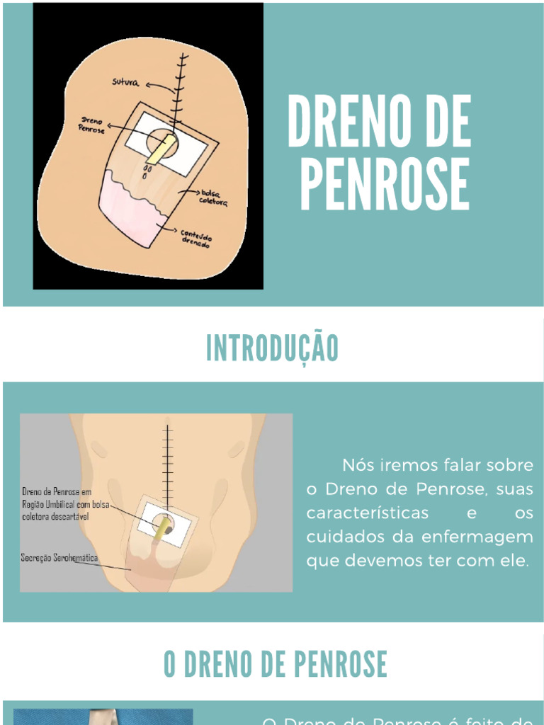 Penrose Drain | PDF