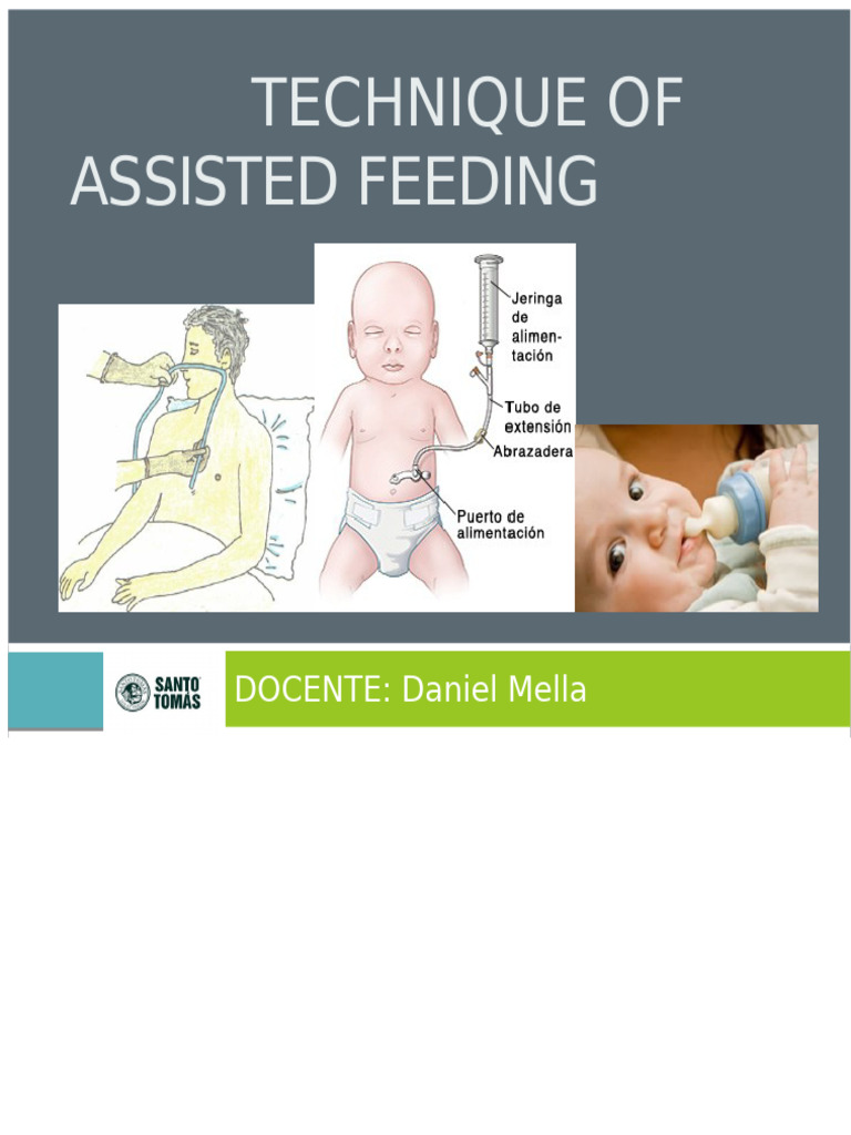 Assisted Feeding Technique | PDF | Clinical Medicine | Medical Specialties
