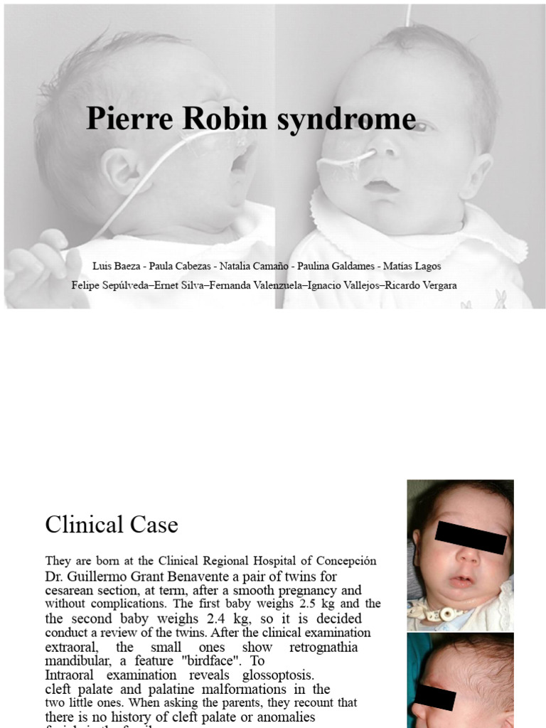 Pierre Robin Syndrome | PDF | Medical Specialties | Diseases And Disorders