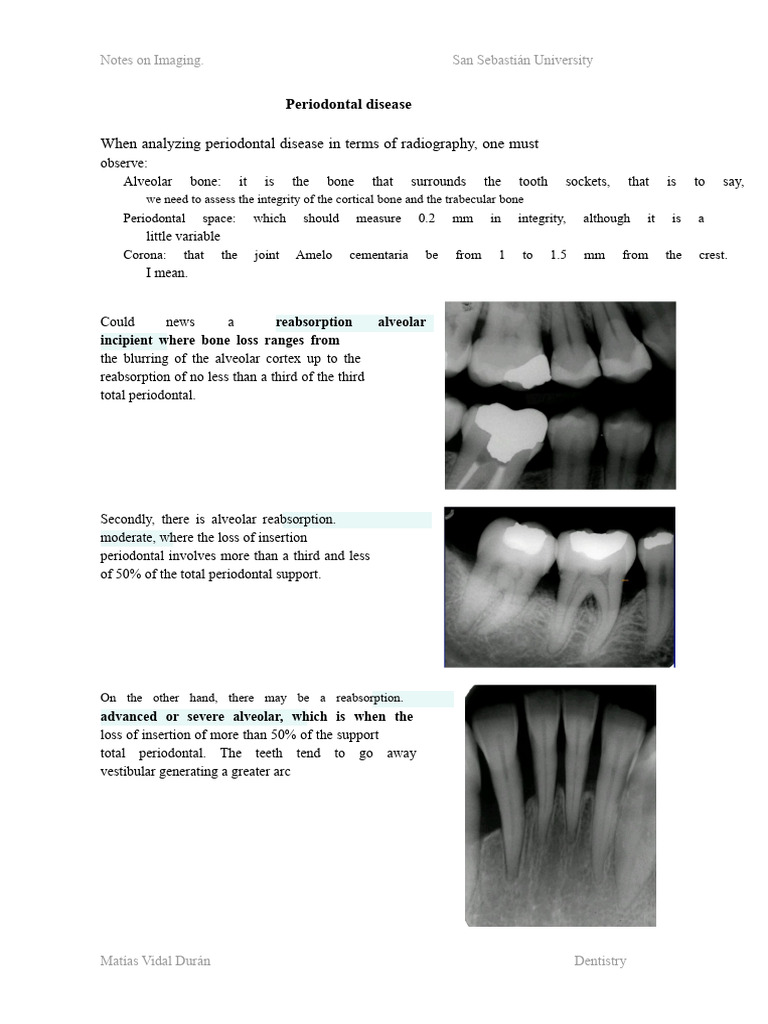 Periodontal Disease | PDF | Periodontology | Dental Anatomy