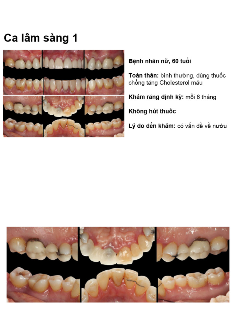 CA Lam Sang Lap KHDT Nhom 2 | PDF