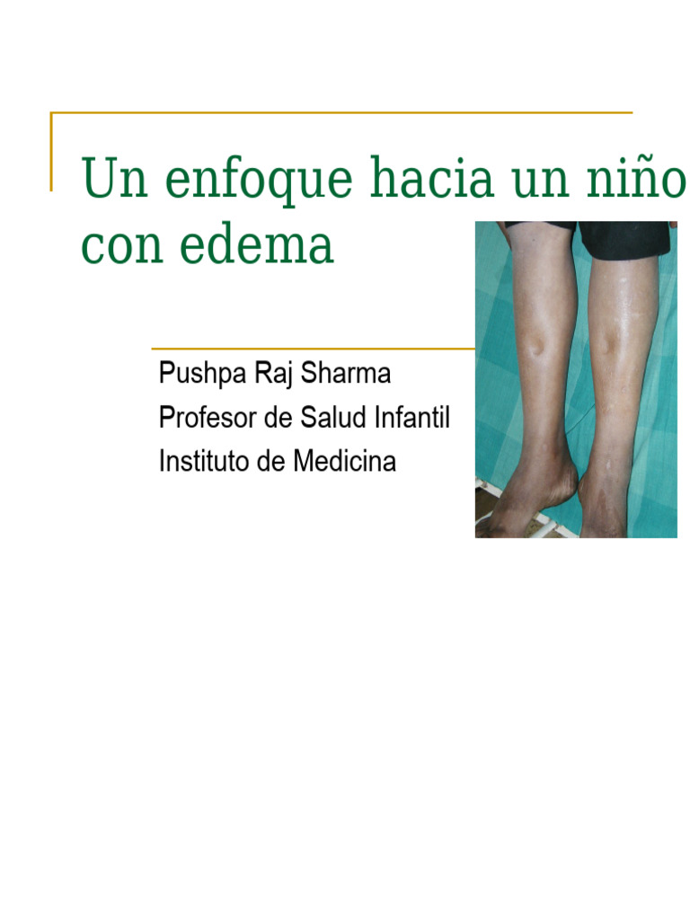 Un Enfoque Hacia Un Niño Con Edema | PDF | Edema | Medicina CLINICA