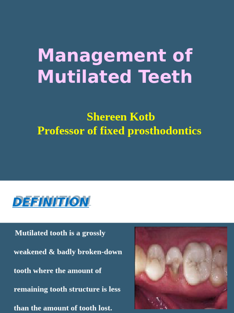 Management of Mutilated Teeth | PDF | Human Tooth | Periodontology