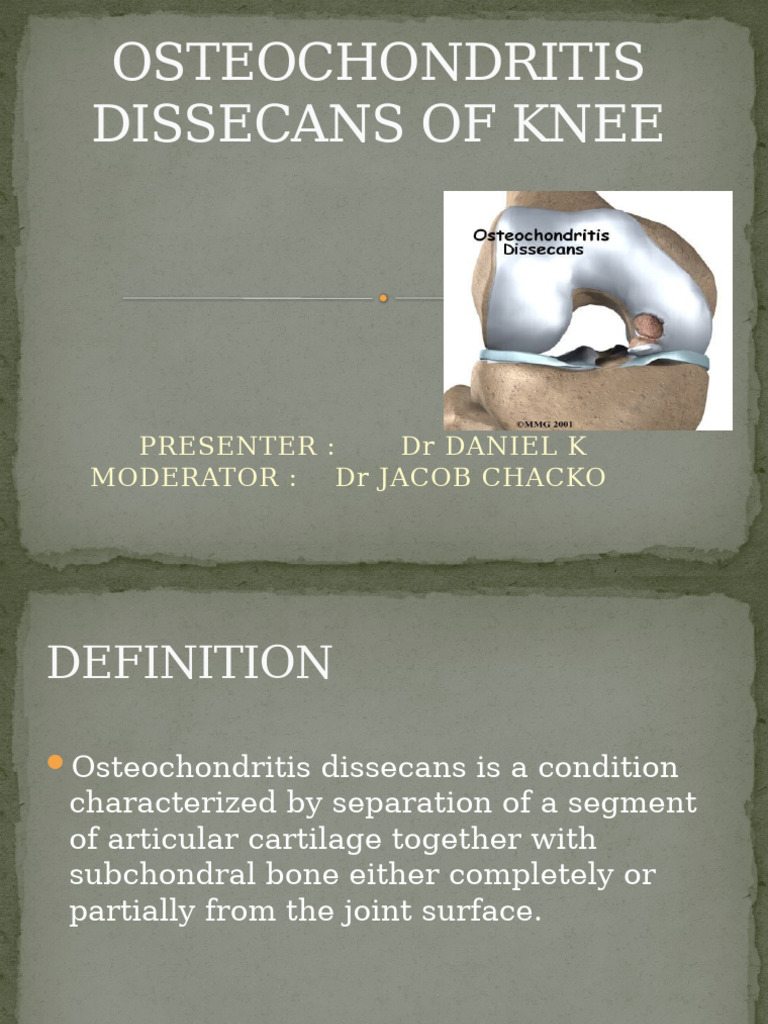 Osteochondritis Dissecans of the Knee | PDF | Skeletal System | Medical ...