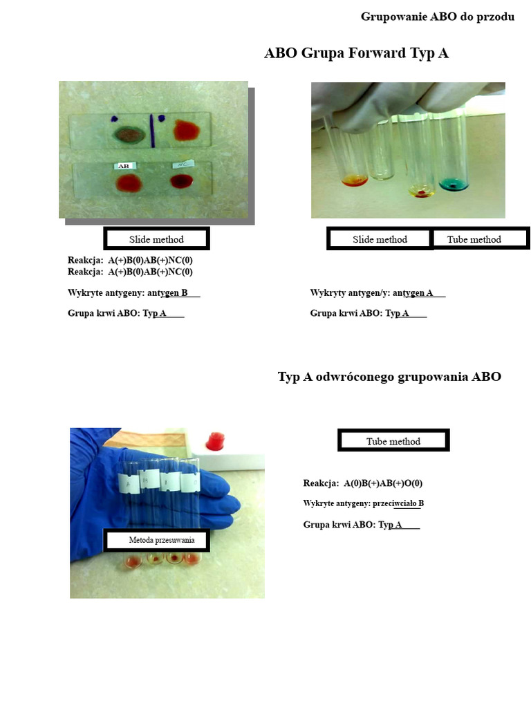 ABO Grouping BB Lab | PDF