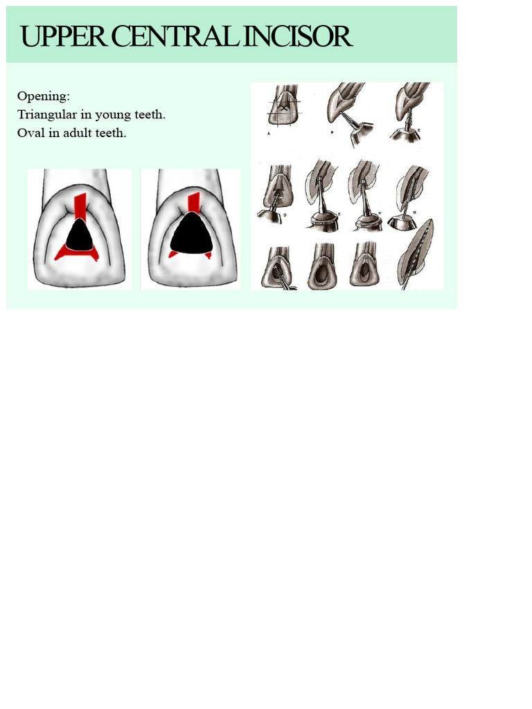 Upper Central Incisor | PDF | Dental Anatomy | Dentistry Branches