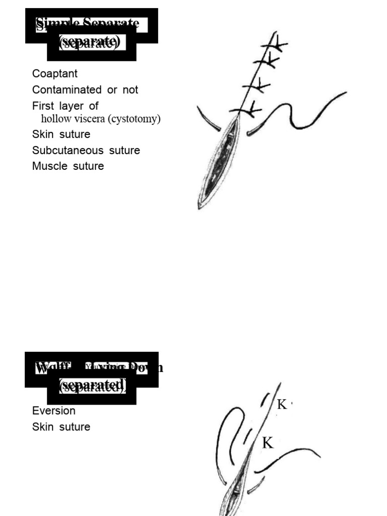 Surgical Suture Techniques Overview | PDF