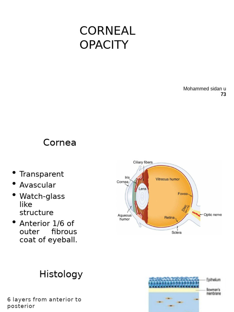 Understanding Corneal Opacity and Treatment | PDF | Cornea | Eye