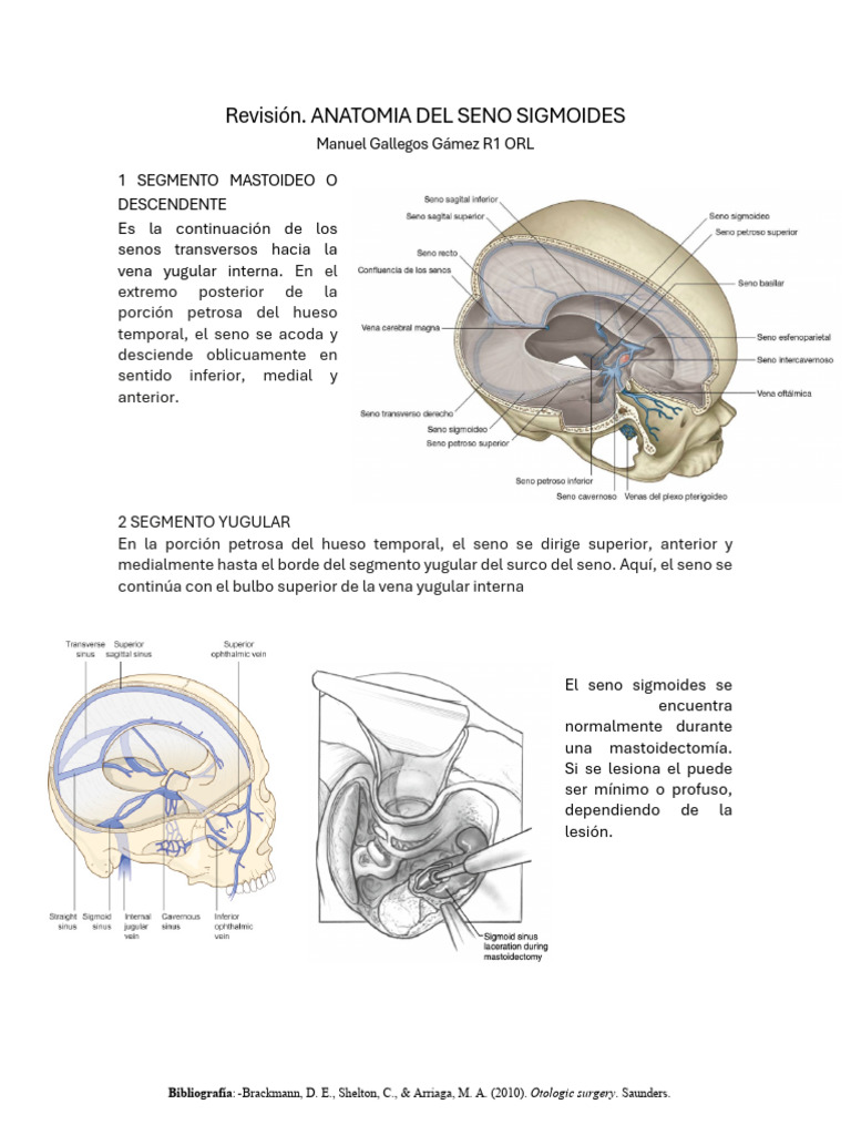Anatomía Del Seno Sigmoides | PDF