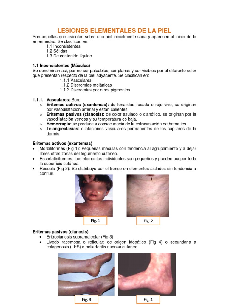 Lesiones Elementales de La Piel | Piel | Epidermis