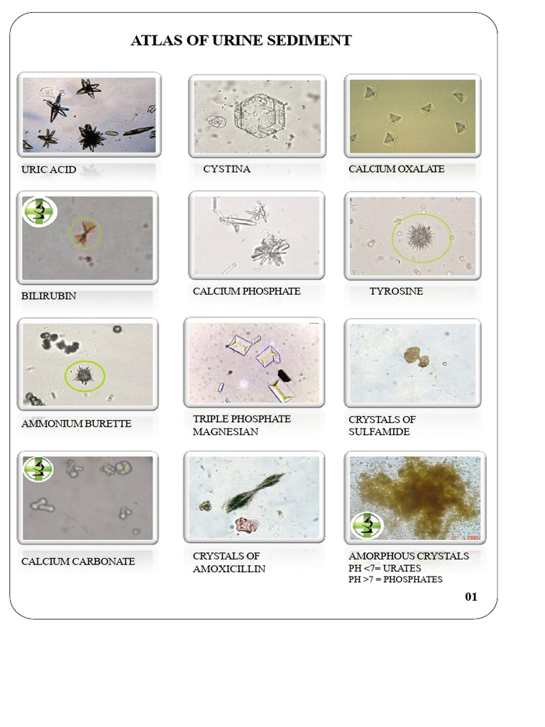 Atlas of Urinary Sediment | PDF