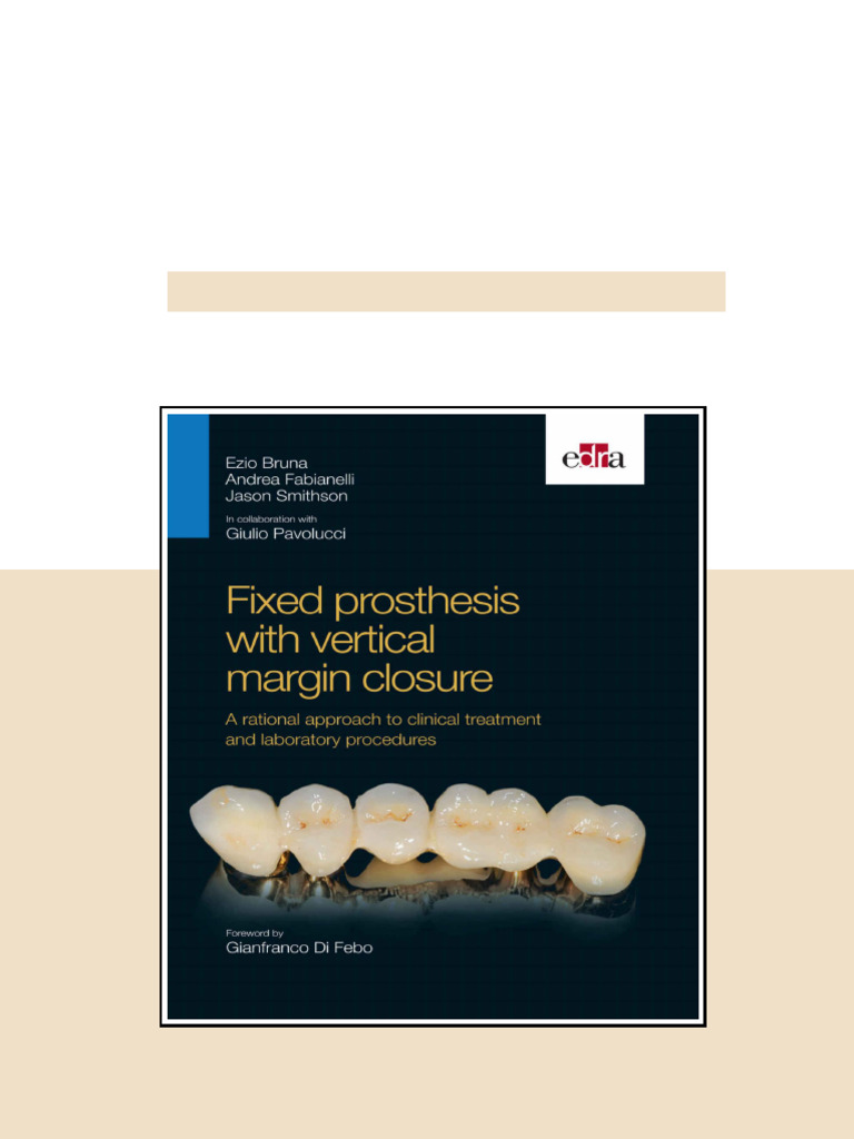 Fixed prosthesis with vertical margin closure Complete Edition | PDF