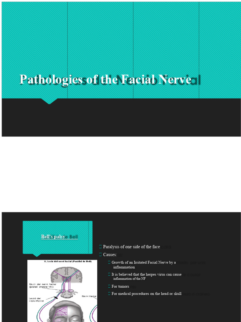 Pathologies of the Facial Nerve | PDF | Human Anatomy | Primate Anatomy