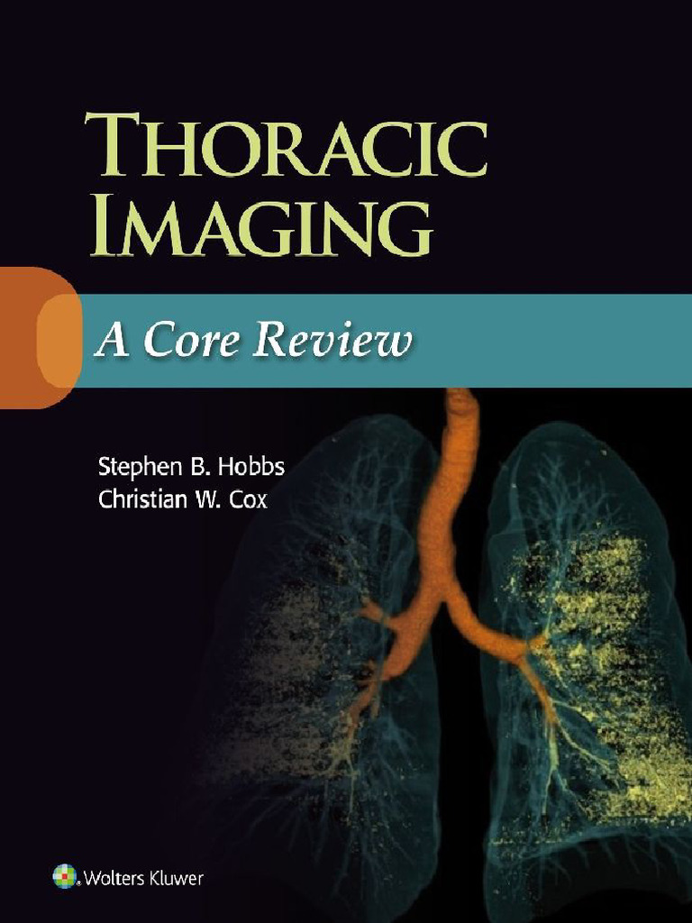 Thoracic Imaging_ a Core Review - Stephen Hobbs | PDF | Ct Scan | Vein