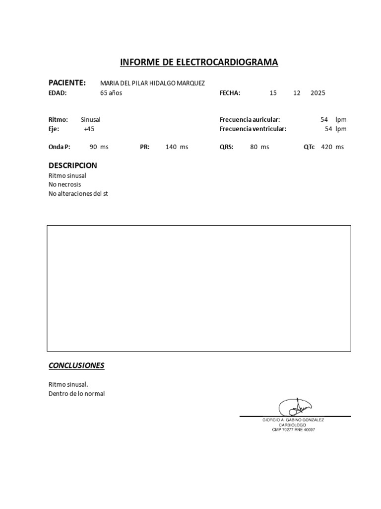 Informe ECG Normal de Paciente de 65 Años | PDF