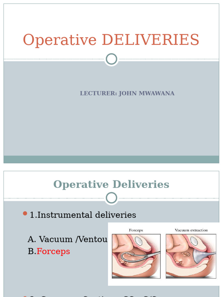 Operative Deliveries | PDF | Childbirth | Vagina
