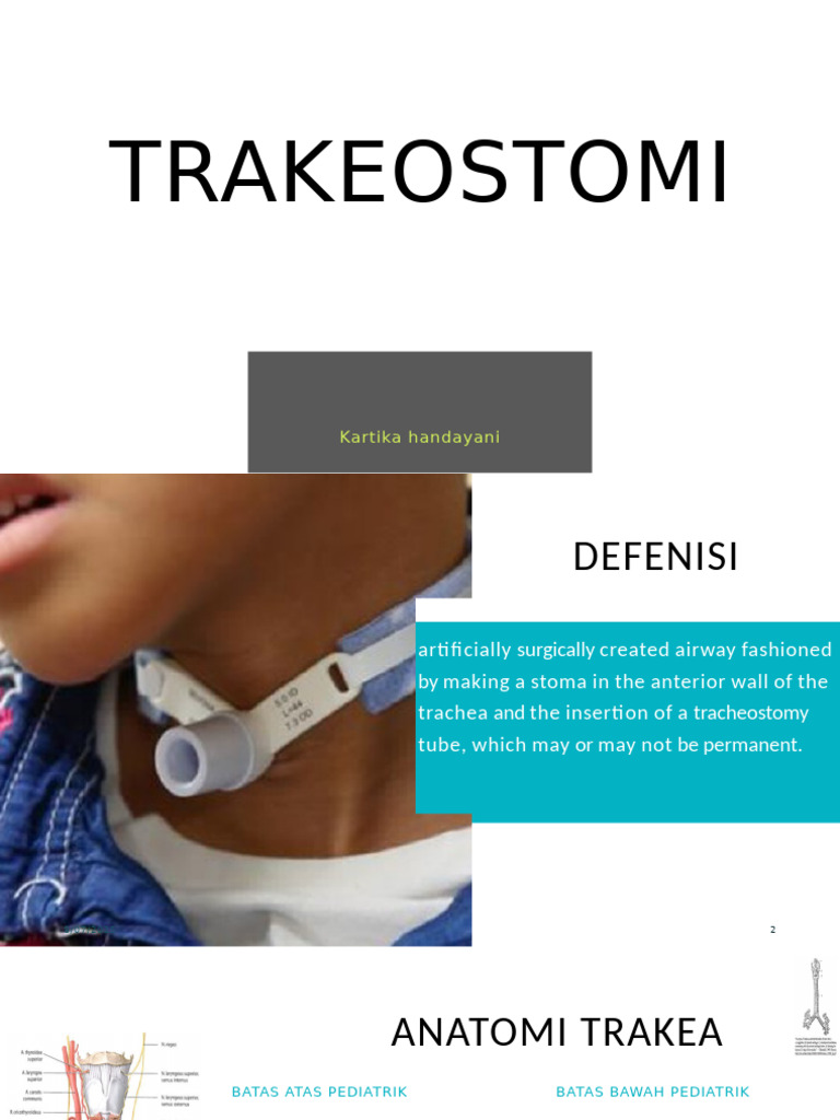 trakeostomi | PDF