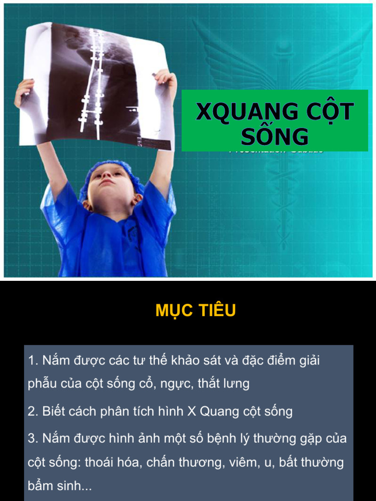 BAI Gui XQ CỘT SỐNG Moi | PDF