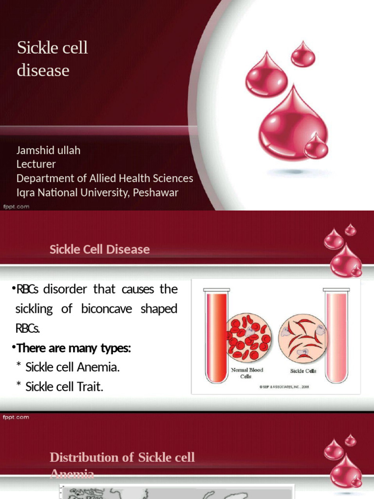 Lecture 9 Sickle Cell Anemia | PDF | Tissue (Biology) | Medical Genetics