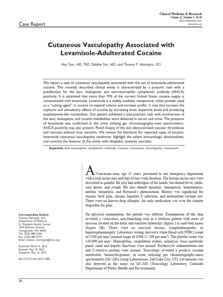 Cutaneous Vasculopathy Associated With Levamisole Adulterated Cocaina ...