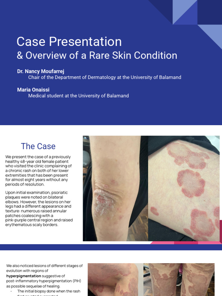 Case Presentation of A Rare Skin Condition Dr. Moufarrej | PDF ...