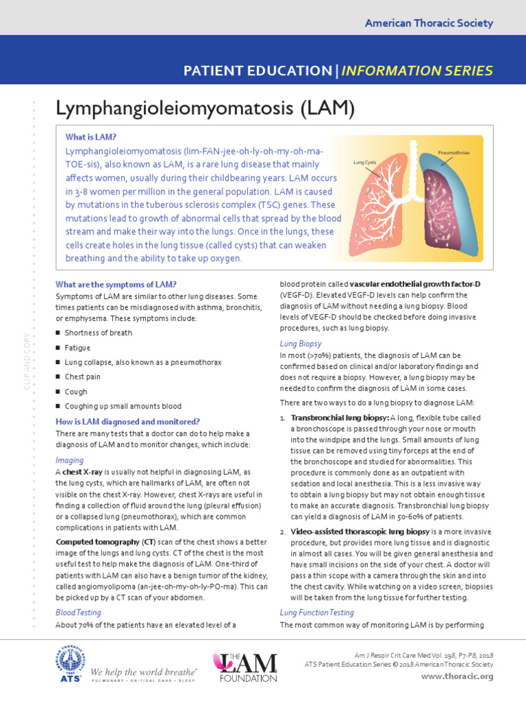 Understanding Lymphangioleiomyomatosis (LAM) | PDF | Lung Cancer ...