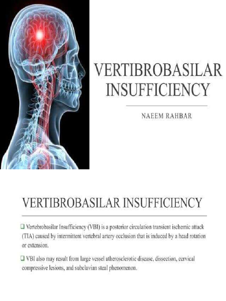 Vertebrobasilar Insuffency | PDF