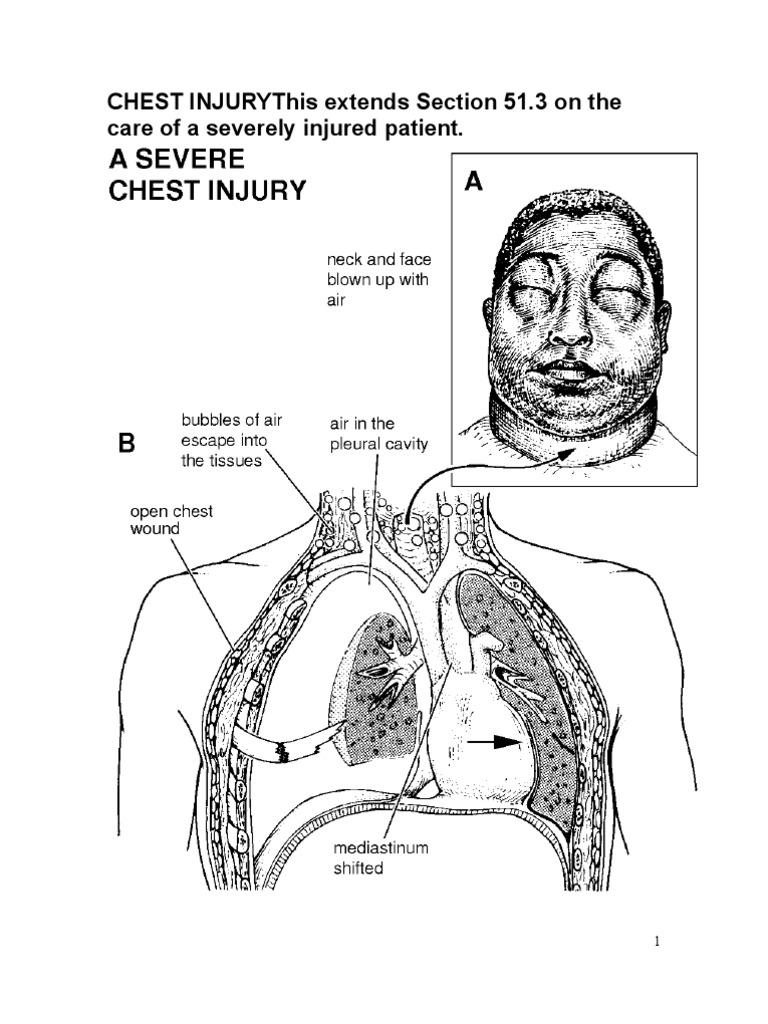 Chest Injury | PDF | Thorax | Lung