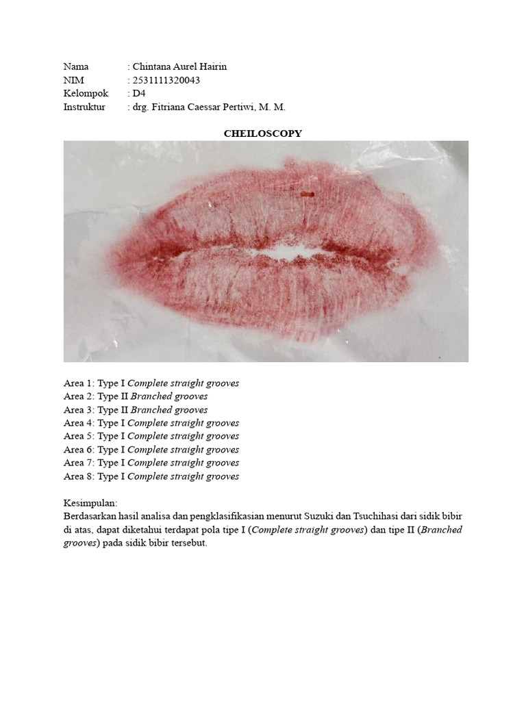 Tugas Cheiloscopy Dan Rugoscopy Chintana | PDF