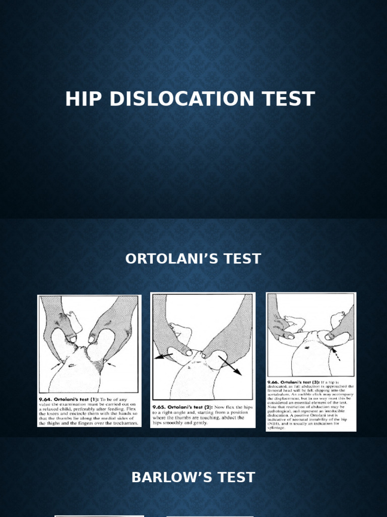 Dislocation Test of Hip | PDF