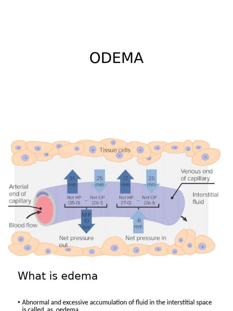 ODEMA | PDF
