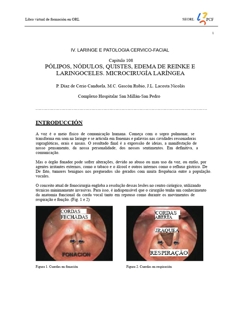 108 - Pólipos, Nódulos, Quistos, Edema de Reinke e Laringoceles ...