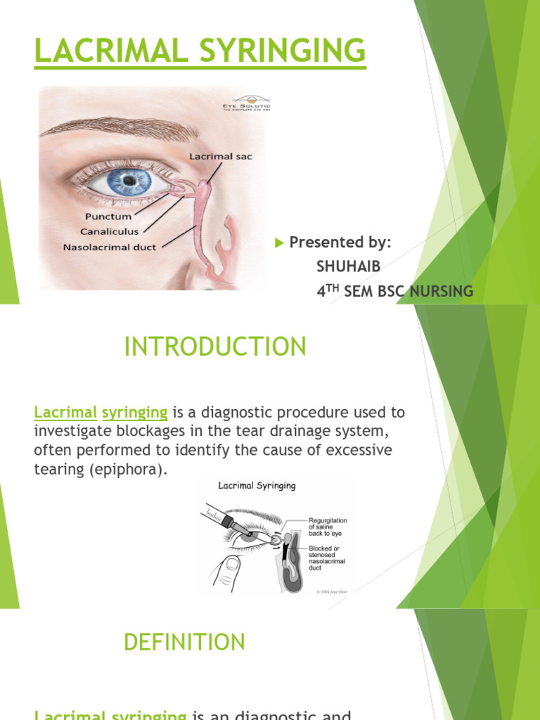 Lacrimal Syringing | PDF | Medical Specialties | Clinical Medicine