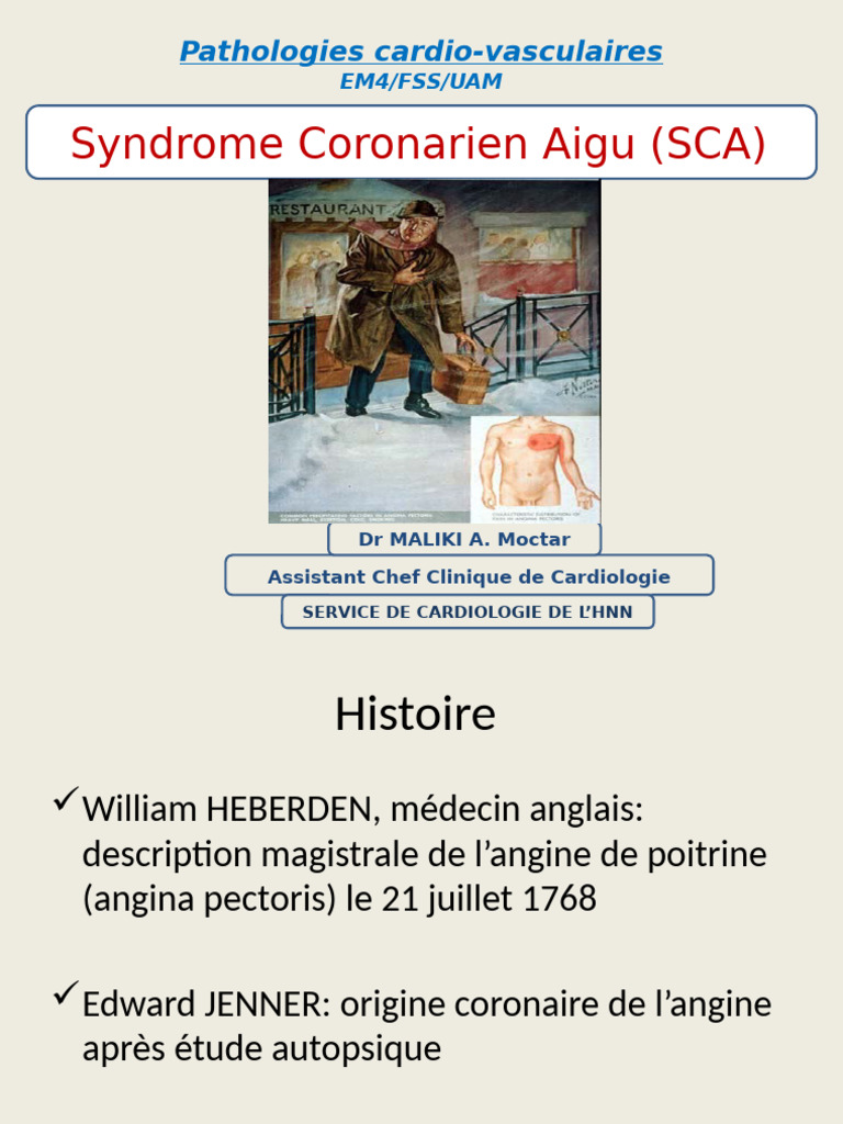 Comprendre le Syndrome Coronarien Aigu | PDF | Infarctus du myocarde ...