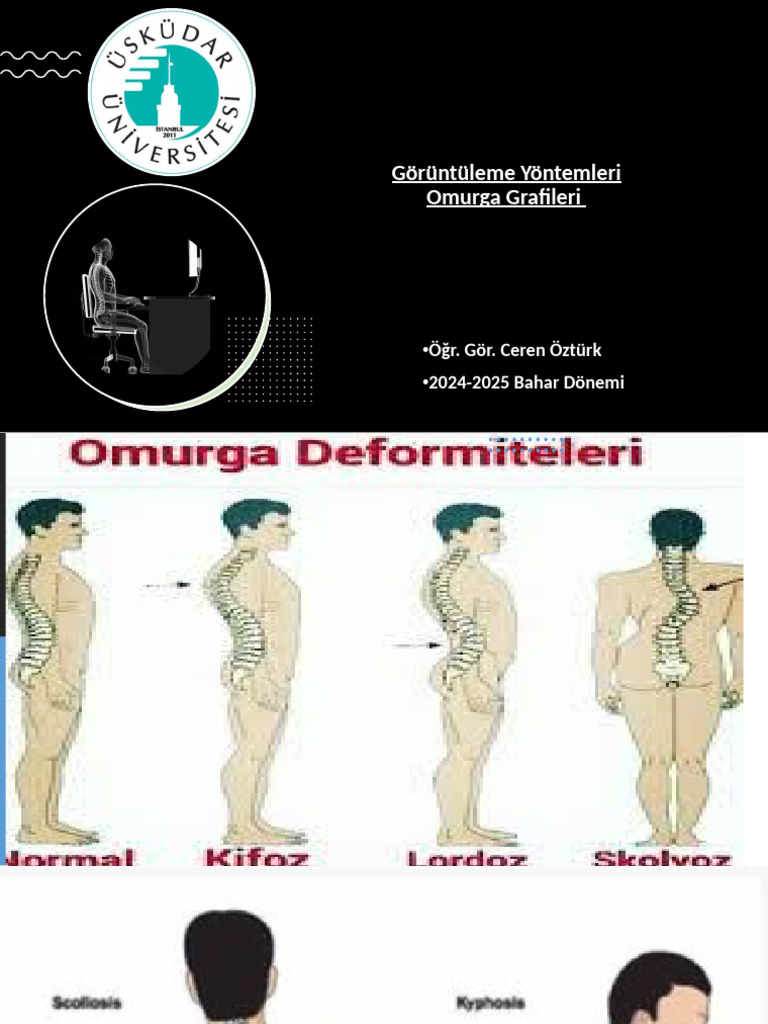 Omurga Rontgen Incelemeleri 4 Bolum | PDF