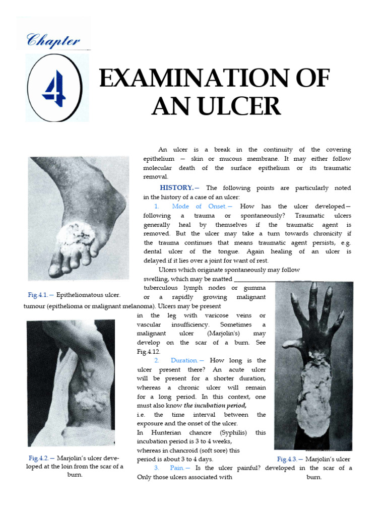 Understanding Ulcers: Types and Examination | PDF | Vein | Ischemia
