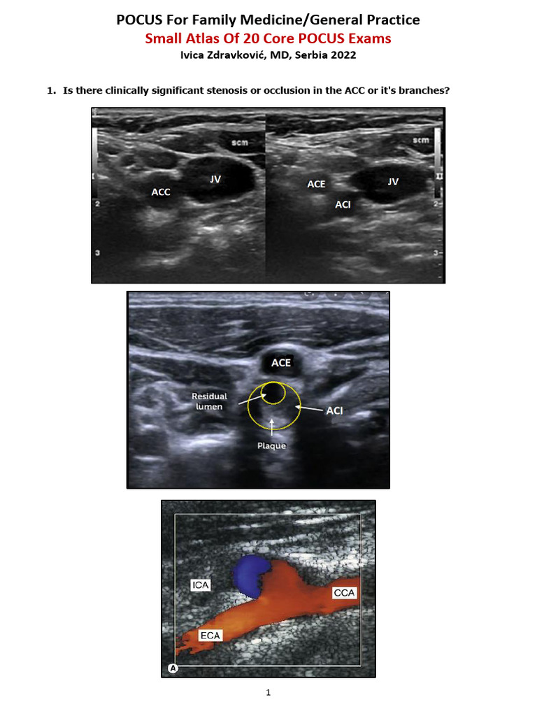 Small Atlas of FM POCUS | PDF | Medical Specialties | Angiology