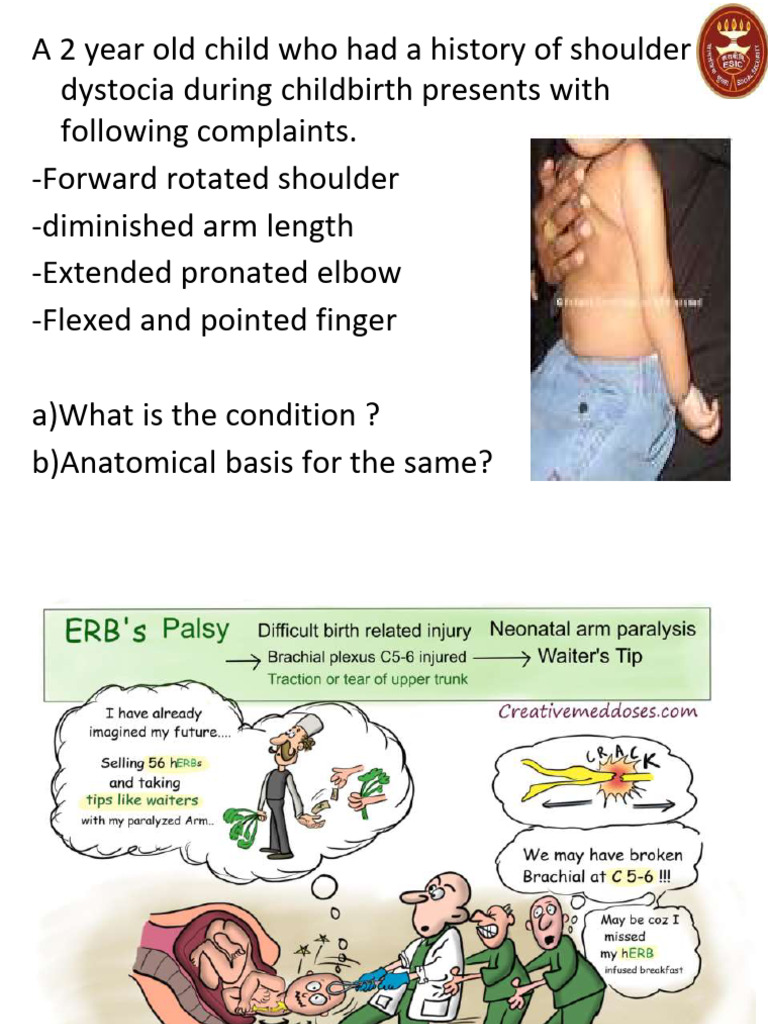 ESIC Anatomy Spotters Slides Cases | PDF | Human Leg | Foot