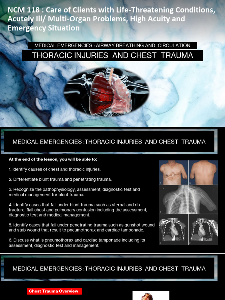 ER Thoracic and Chest Trauma Autosaved | PDF | Thorax | Lung