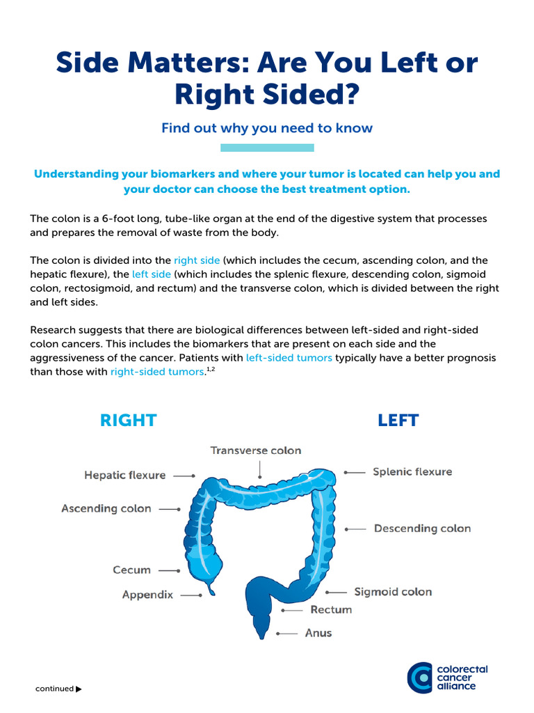 Side Matters Left vs. Right | PDF | Large Intestine | Colorectal Cancer