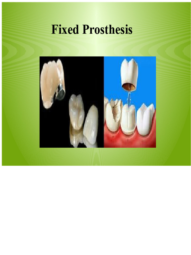 FIXED PROSTHESIS Udabol | PDF | Dentistry Branches | Tooth