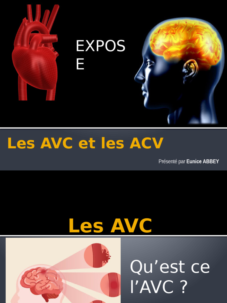 AVC : Types, Risques et Prise en Charge | PDF | Accident vasculaire ...