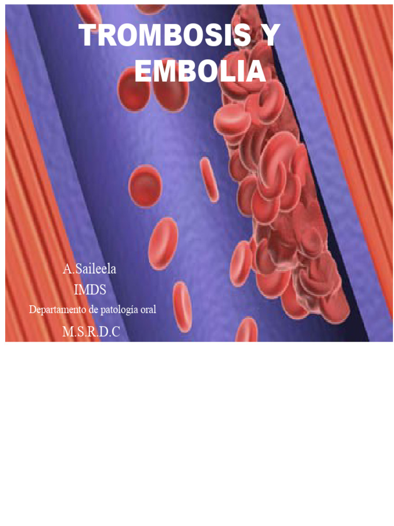 Trombosis y Embolia: Patogénesis y Tipos | PDF | Embolia | Trombo