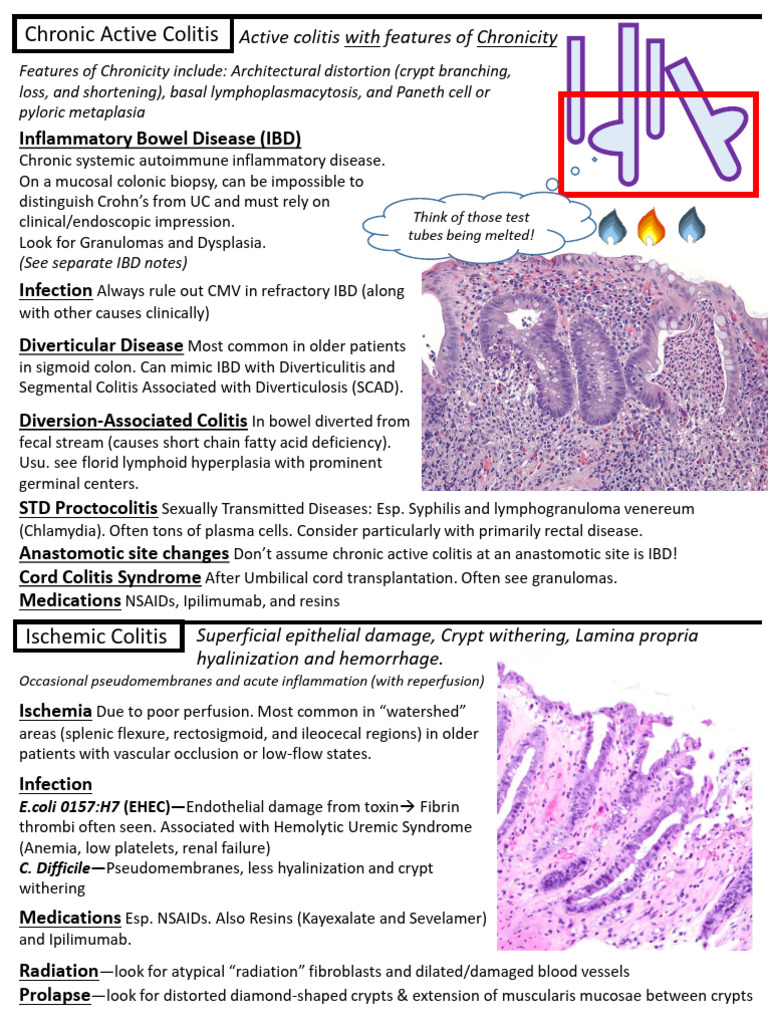 Inflammatory GI 10 | PDF