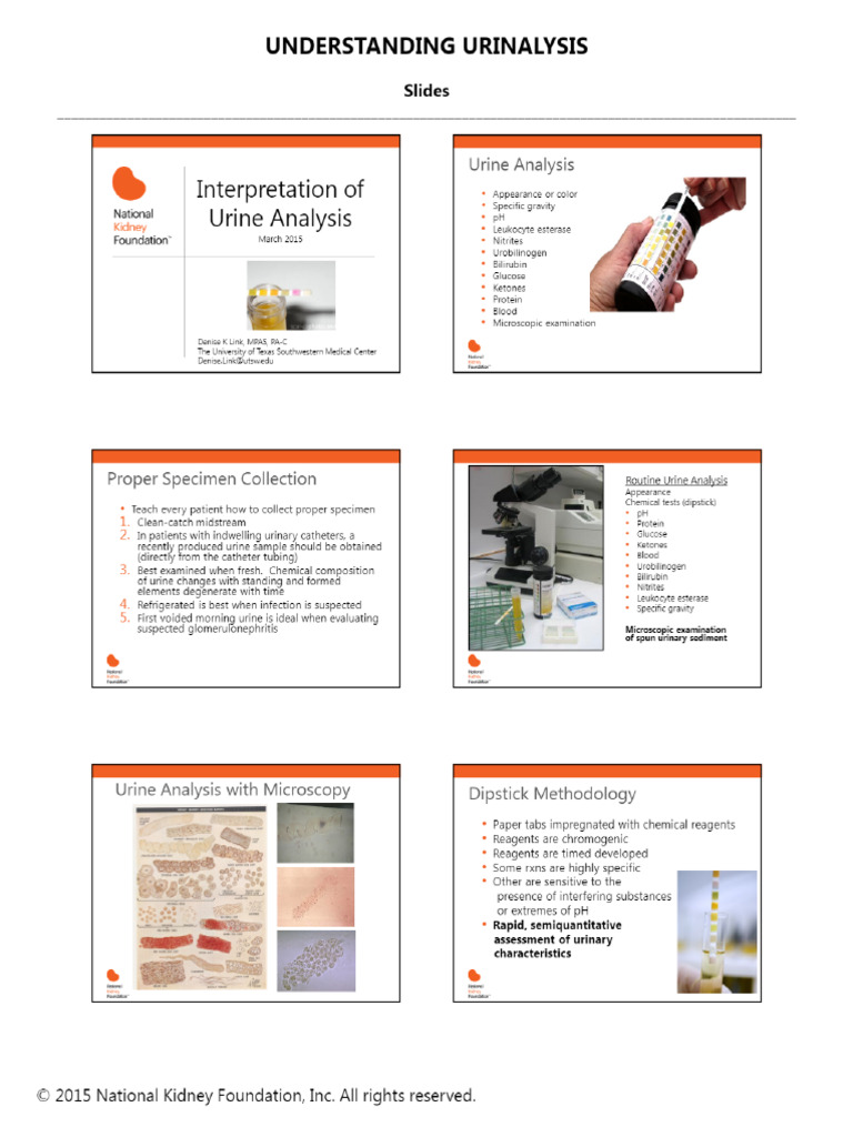 Urine Analysis Interpretation of Urine Analysis Preview | PDF