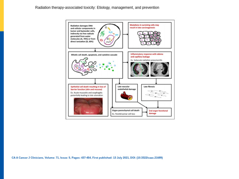 Radiation Therapy Toxicity Management | PDF