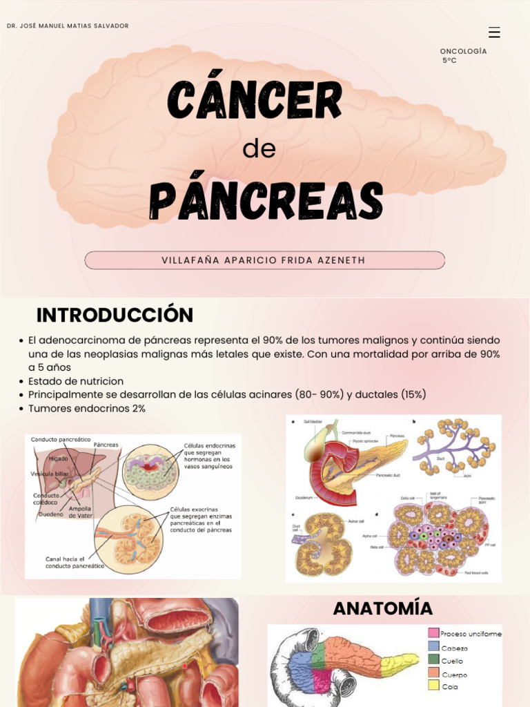 Cancer de Pancreas | PDF | Cáncer de páncreas | Cáncer