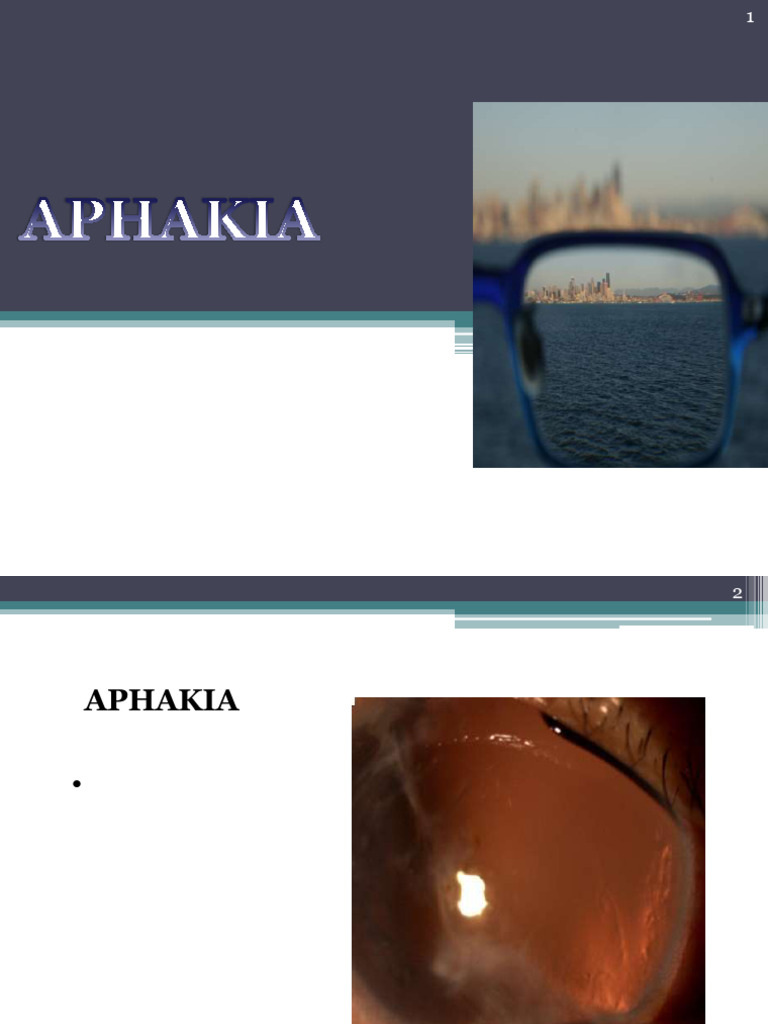 aphakia AVF | PDF | Visual System | Eye