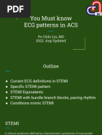 ECG Criteria for STEMI and J-Point | PDF | Electrocardiography ...