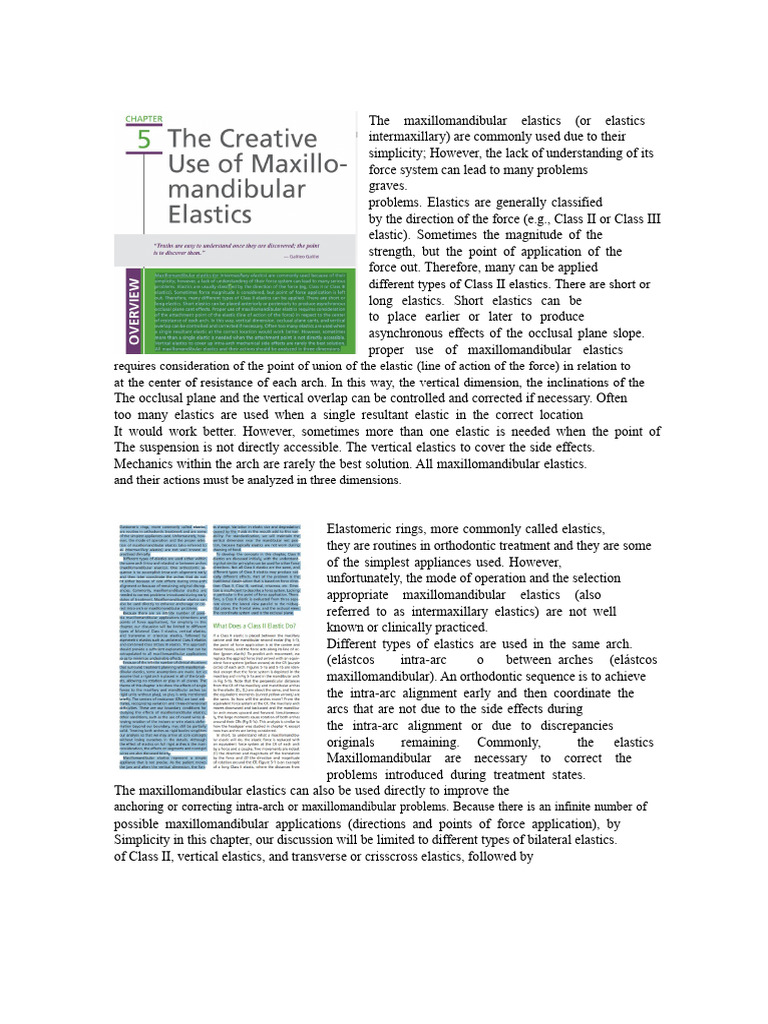 The Maxillomandibular Elastics Translation From The Burstone Chapter ...